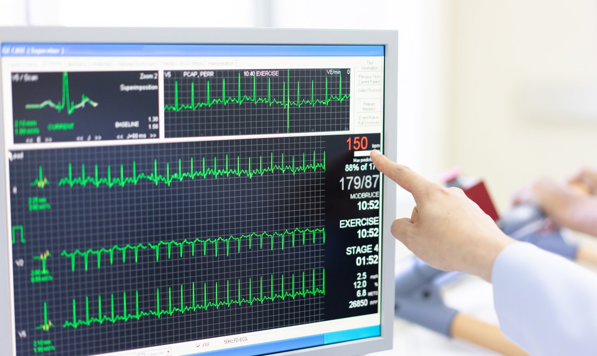 Medicalgorithmics liczy na ekspansję - parkiet.com