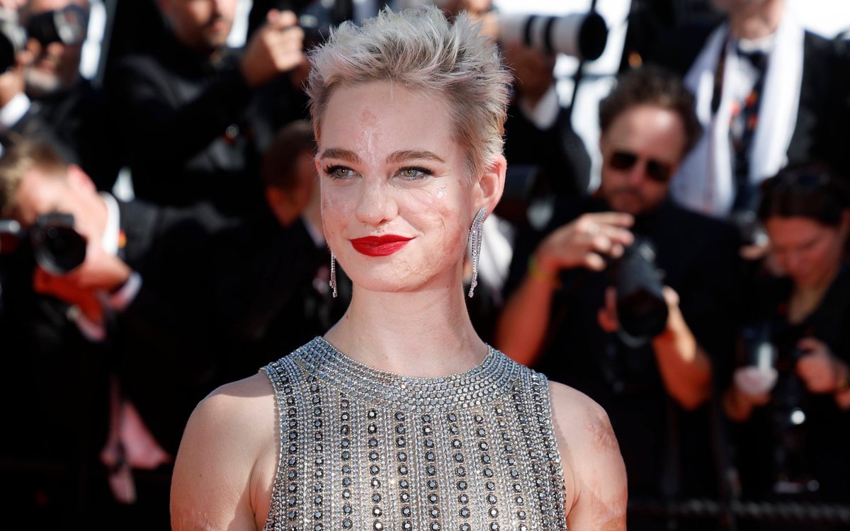 Kim jest Bebe Vio? - rp.pl