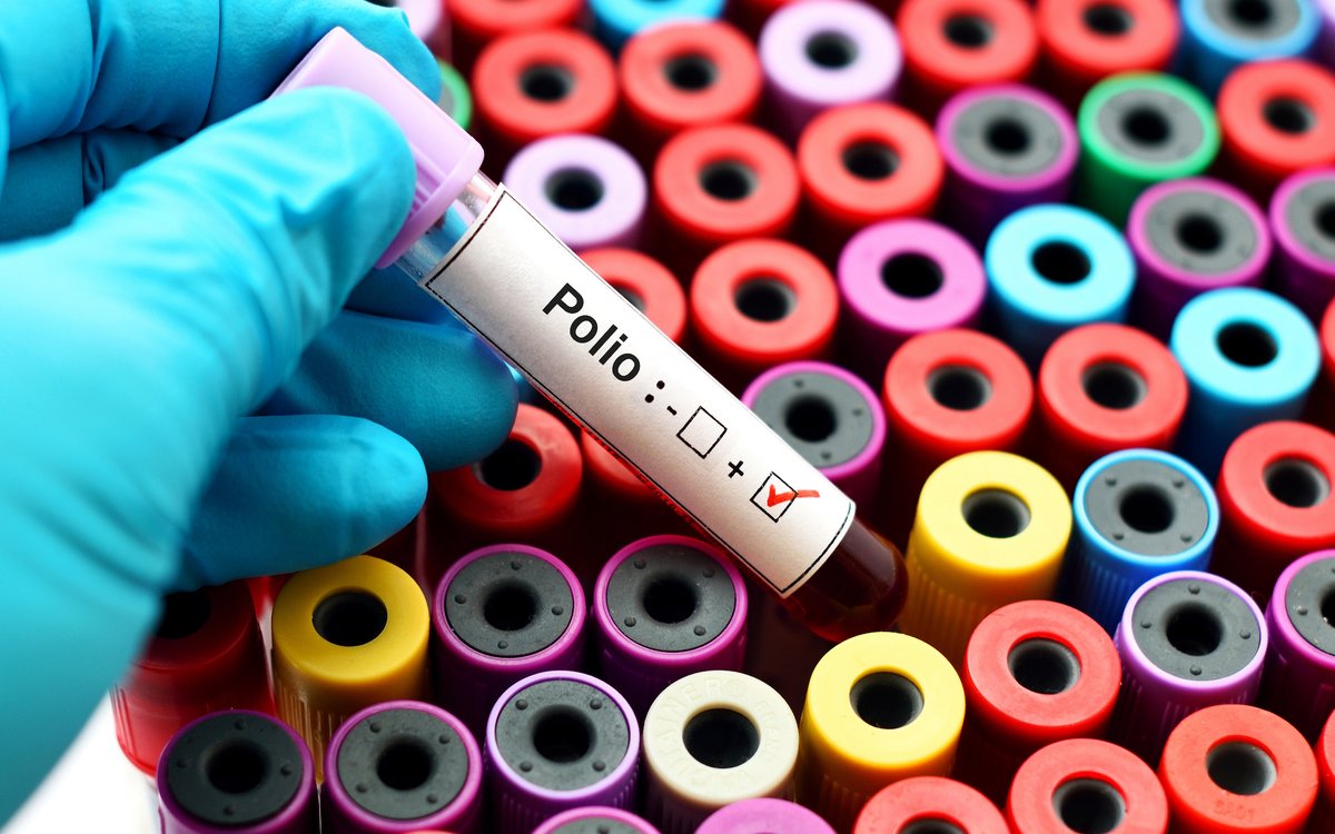 Wirus polio w ściekach w Nowym Jorku. Ruszyły masowe szczepienia - rp.pl