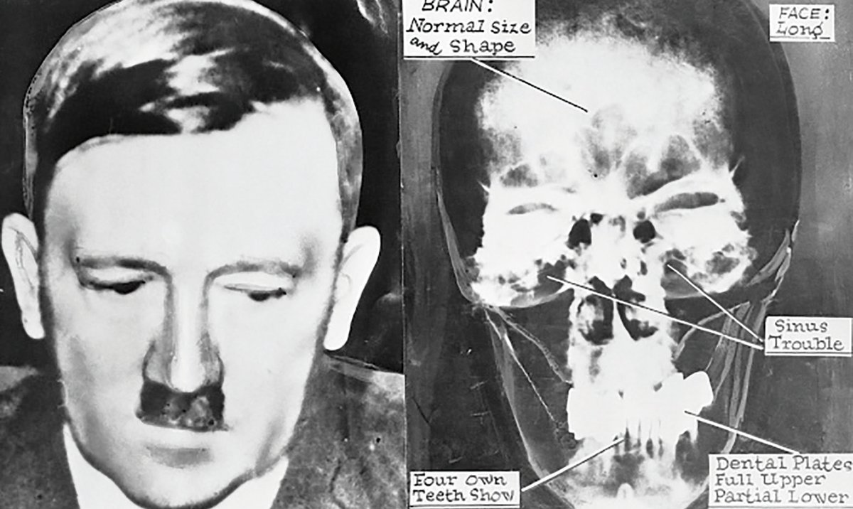 Ponury dowód na śmierć Adolfa Hitlera - rp.pl